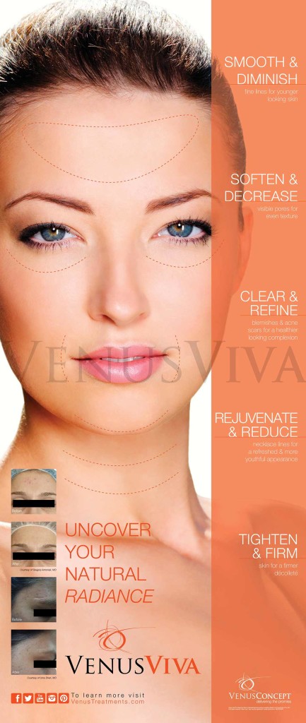 Venus Viva | Skin Resurfacing | StarSpa Uptown